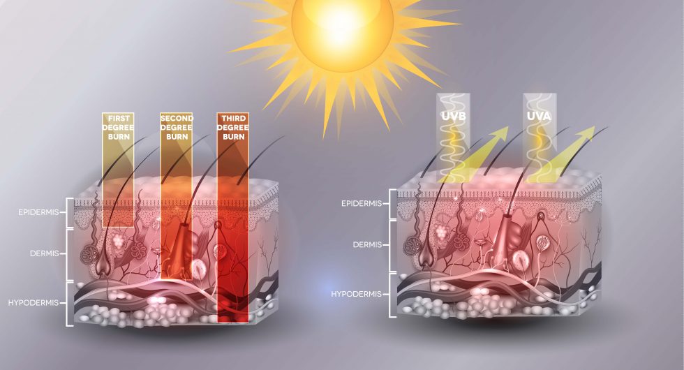 PHOTOAGING: HOW SUN EXPOSURE ACCELERATES SKIN AGING