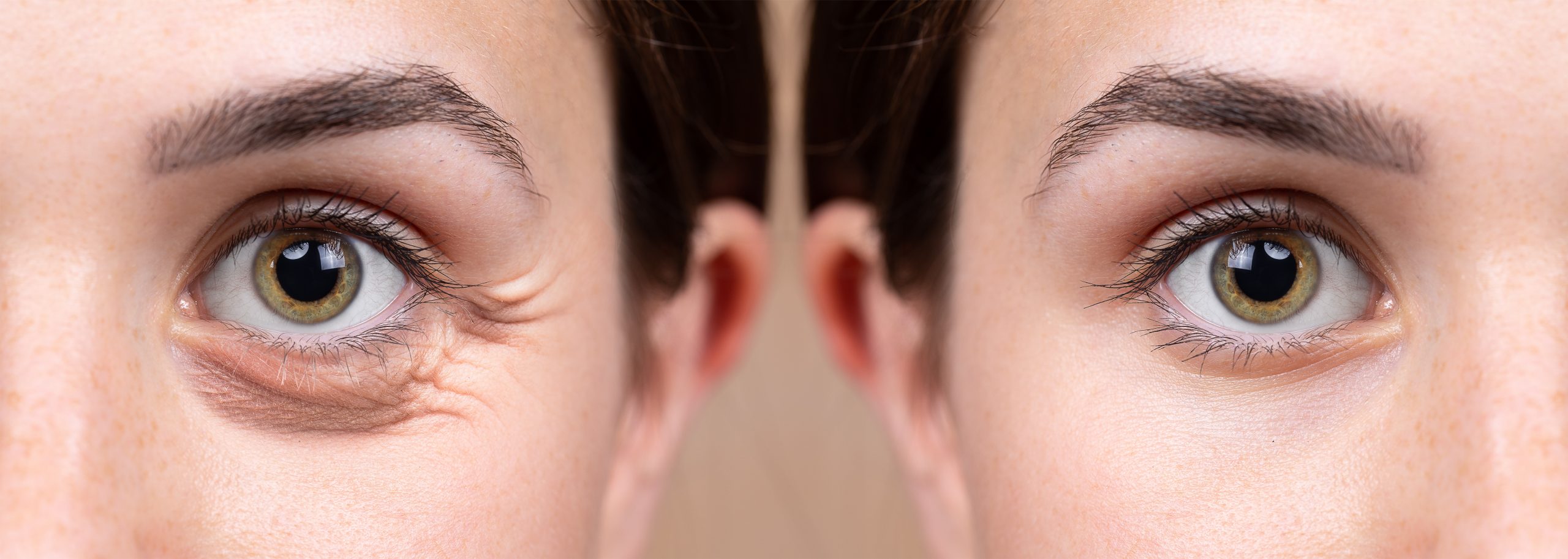 HOW TO TAKE THE BEST CARE OF YOUR EYE CONTOUR - INNOAESTHETICS