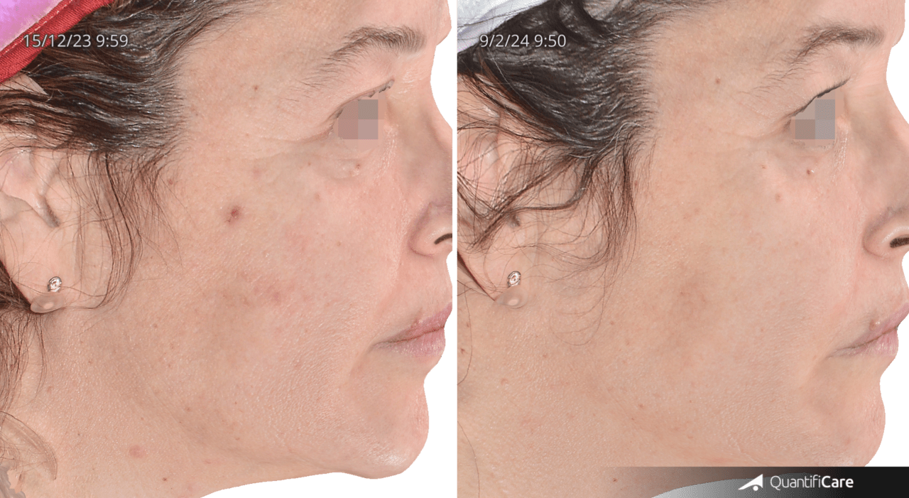 INNO-EXOMA - INNOAESTHETICS