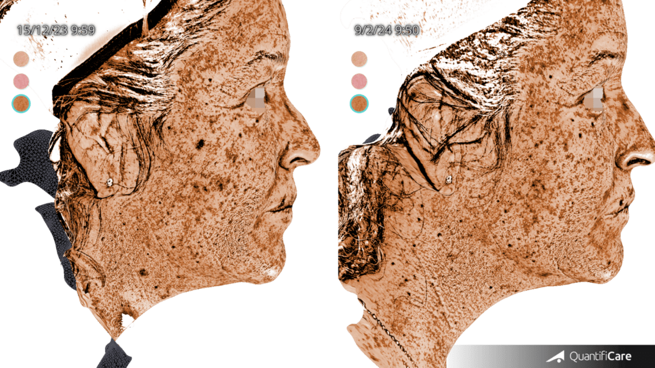 INNO-EXOMA - INNOAESTHETICS