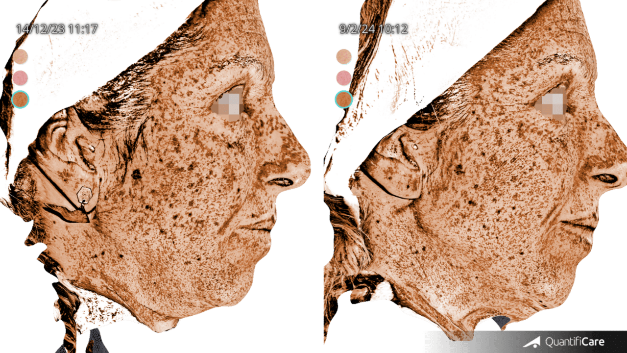 INNO-EXOMA - INNOAESTHETICS