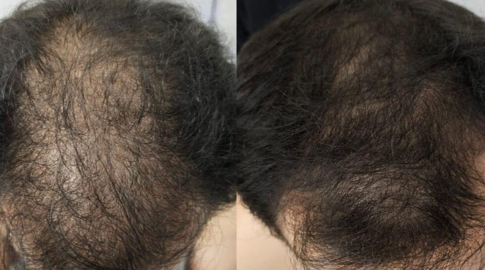 INNO-EXOMA® EXO-SKIN: THE FIRST SYNTHETIC EXOSOME DEVELOPED IN EUROPE ...